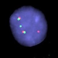 Fluorescent Insitu Hybridisation (FISH) | Online Genetic Counselling